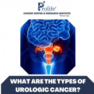 What are the types of urologic cancers? | Prolife Cancer Centre