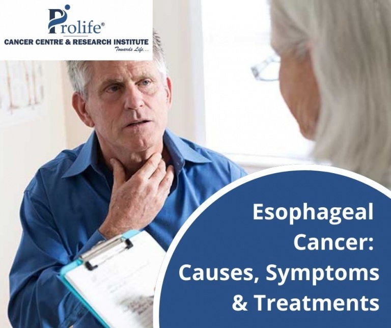Esophageal Cancer: Symptoms and Treatment | Prolife Cancer Centre