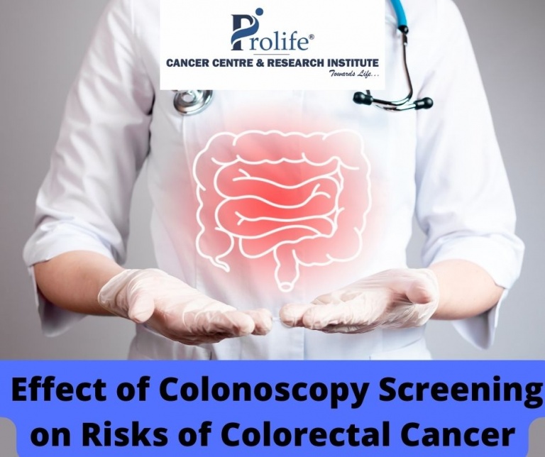 Effect of Colonoscopy Screening on Risks of Colorectal Cancer