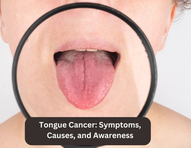 Tongue Cancer: Symptoms, Causes, & Awareness | Dr. Sumit Shah