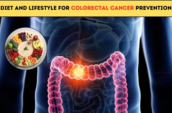 A Guide to Diet and Lifestyle for Colorectal Cancer Prevention ...